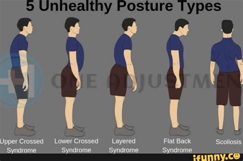 Scoliosis Memes Best Collection Of Funny Scoliosis Pictures On Ifunny