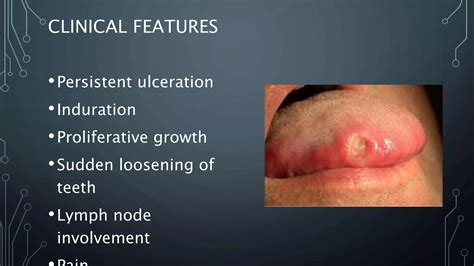 Precancerous Lesions And Conditions Pptx
