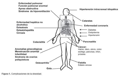 Relación De La Obesidad Con El Asma Y La Función Pulmonar