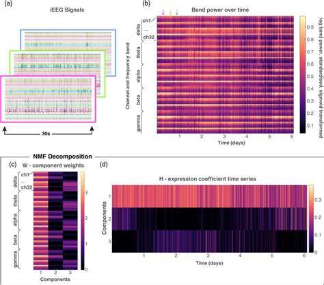 Workflow Of Data Preprocessing Calculation Of Band Power In 30 S