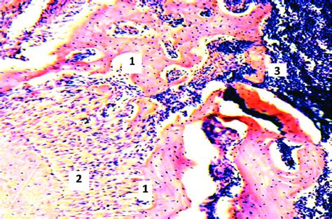 Microphotograph Of The Defect Of The Mandible In A Rat Of The