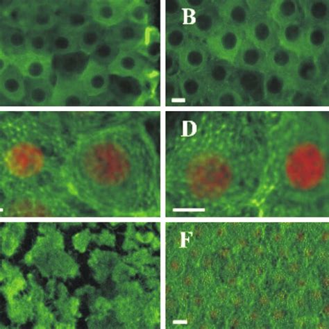 The Organization Of Actin Filaments Visualized By Phalloidin Labeling