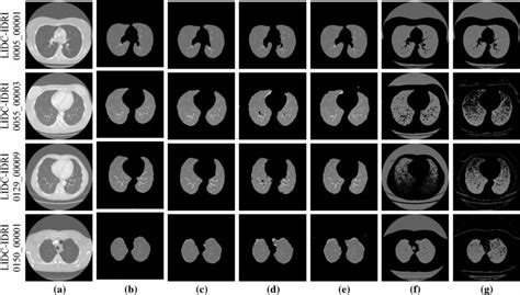 Visual Results Of Different Lung Segmentation Methods On Lidc Idri Download Scientific Diagram