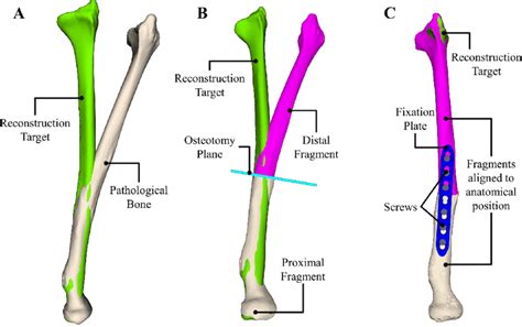 Long Bone Model Anatomy Of A Long Bone Model 1 Diagram Quizlet Long