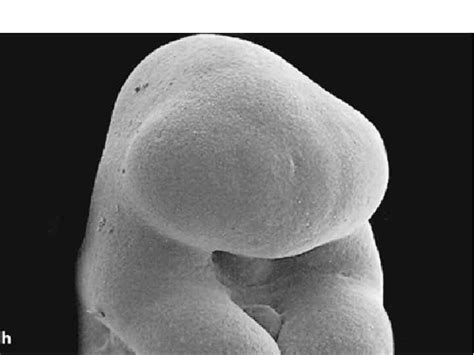 Transverse Sections Showing Development Of The Mesodermal Germ