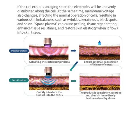 ₩2188830에서 의료 콜드 플라즈마 펜 피부 여드름 표면 처리 제트 플라즈마 바늘 팁 25 핀 눈꺼풀 안면 성형 섬유 아세포 기계 살롱 사용 Dhgate
