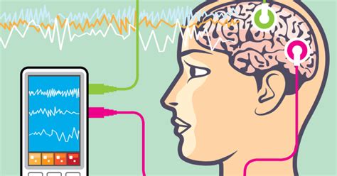 Sleep Analysis Polysomnography German Neuroscience Center Dubai 1