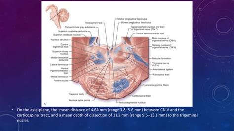 Brain Stem Surgical Anatomy And Approaches Pptx Death Injury Or