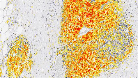 Area Quantification Indica Labs