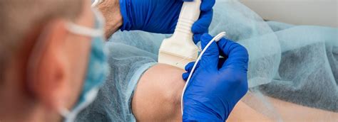 Rf Ablation Side Effects