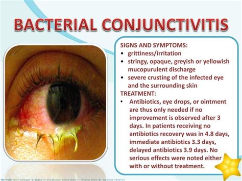Primary Health Care Conjunctivitis Pdf