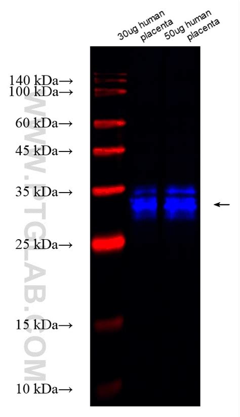 Tfpi2 Antibody Cl750 83279 Proteintech