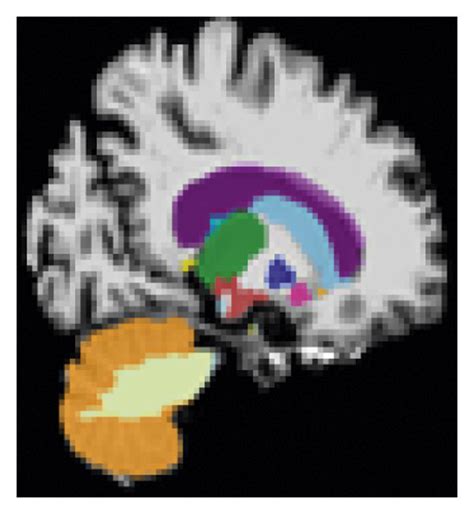 subcortical brain segmentation download scientific diagram
