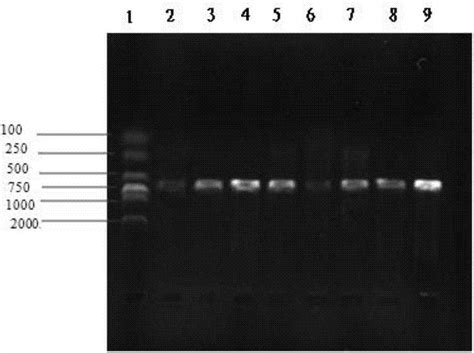 Snp Single Nucleotide Polymorphism Molecular Marker For Peroxisome Proliferator Activated