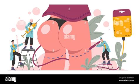 Buttock Enlargement Surgery Butt Beauty Procedure Breech Lifting And