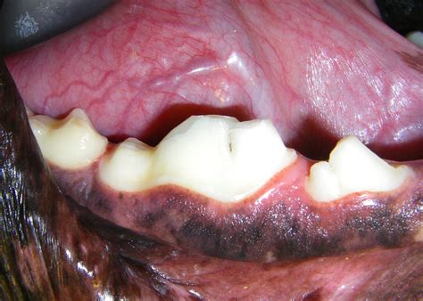 Update On Endodontic Restorative And Prosthodontic Therapy
