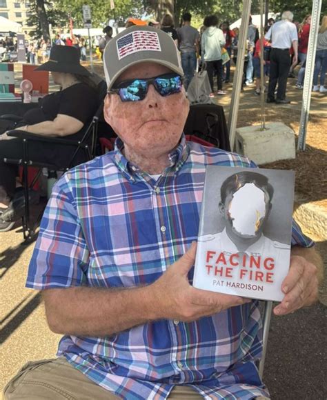 Pat Hardison Mississippis First Face Transplant Survivor Tells A