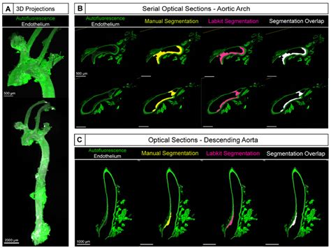 Light Sheet Fluorescent Microscopy Coupled With Labkit Derived