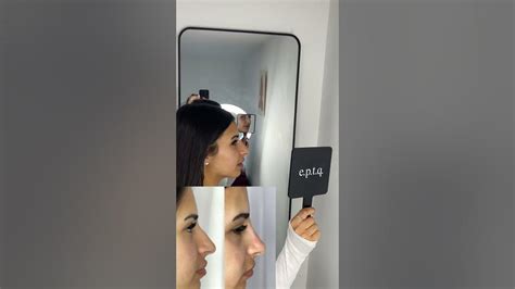 דר טל קפלן חושף תוצאות מושלמות Youtube