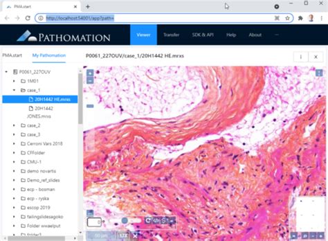 Free Desktop Viewer Pma Start Pathomation