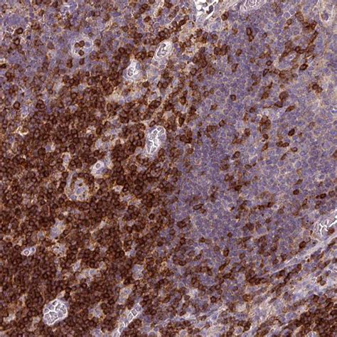 Rabbit Polyclonal Anti Cd3g Antibody Buy For Research Highly Specific Rigorously Validated