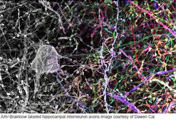 Evolution Of Brainbow Using Cre Lox For Multicolor Labeling Of Neurons
