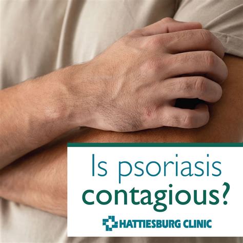 Hattiesburg Clinic Pa On Linkedin Is Psoriasis Contagious A Common