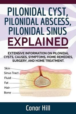 Pilonidal Cyst Fast Healing Guide Fast Track Guide To Pilonidal Cyst