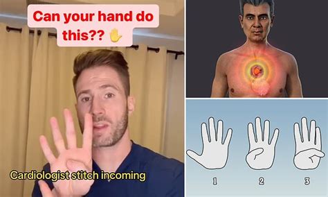 Er Doctor Claims Simple Thumb Test Can Tell If You Ll Suffer A Deadly