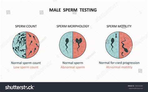 Spermogram Analysis Male Sperm Norm Deviation 库存矢量图（免版税）728236384
