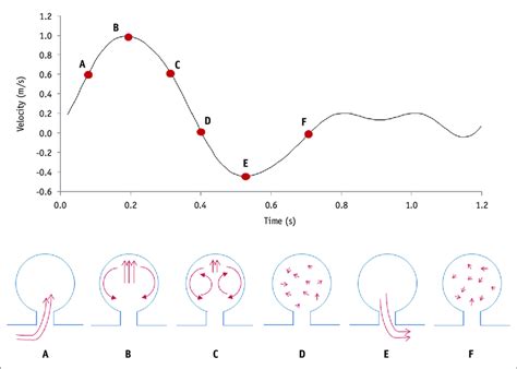Flow Pattern In A Pseudoaneurysm The Velocity Waveform Seen In The Download Scientific Diagram