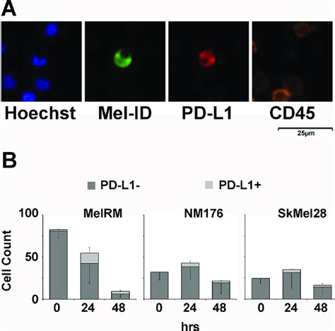 Pd L1 On Melanoma Ctcs A Representative Melanoma Ctc Identification