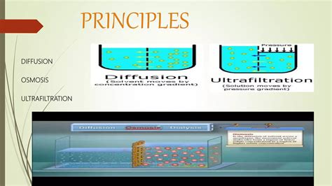 Hemodialysis Pptx