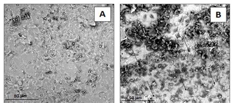 Scanning Electron Microscope Sem Micrographs Of A Ceramic Substrate