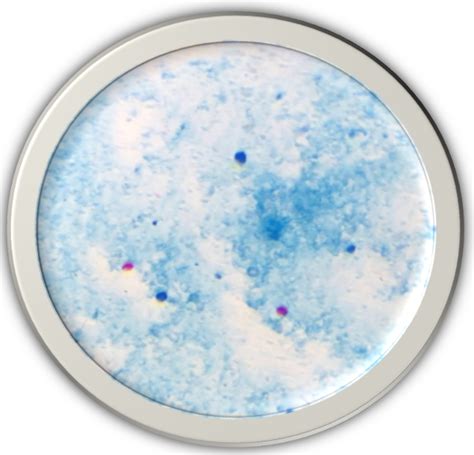 Modified Kinyouns Staining Showing Cryptosporidium Oocyst Download