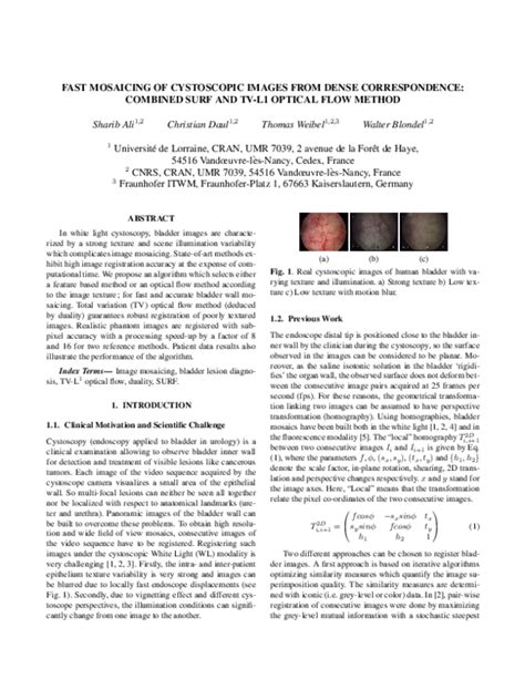 pdf fast mosaicing of cystoscopic images from dense correspondence