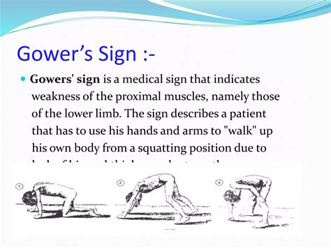 Muscular Dystrophy Pptx