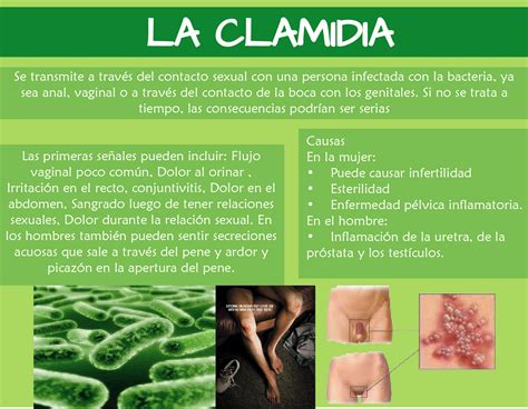 Enfermedades Infecciosas Infecciones De Trasmisión Sexual Clamidia