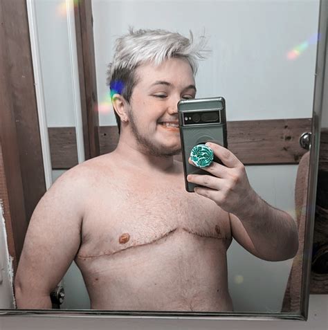 4 Weeks Post Op 🥳 And I Saw A Rainbow Today Happy Pride 🌈 Post