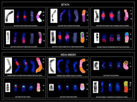 Analysis Of Chr17 Using G Banding Dual Color Fish Her2cep17
