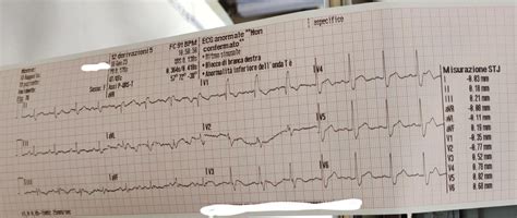 76yo F Witnessed Cardiac Arrest Ecg Post Rosc Rekgs
