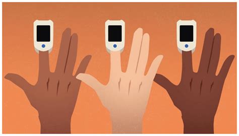 Pulse Oximetry Welcome To Probe Lab