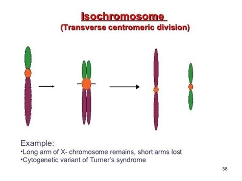 Isochromosome ~ Detailed Information Photos Videos