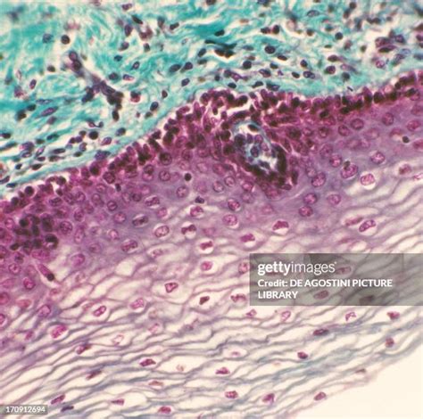 Epithelial Photos And Premium High Res Pictures Getty Images