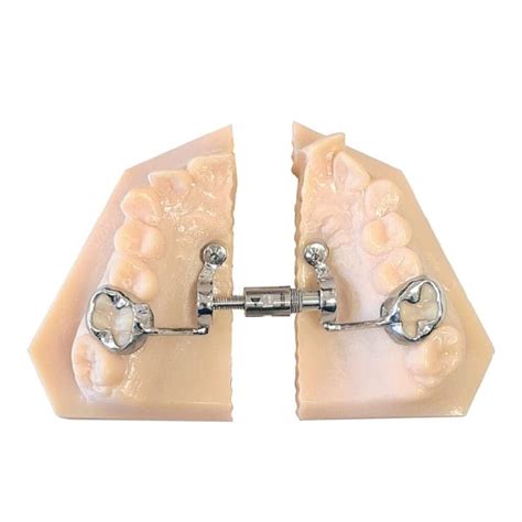 W Arch Odl Orthodontic Labs