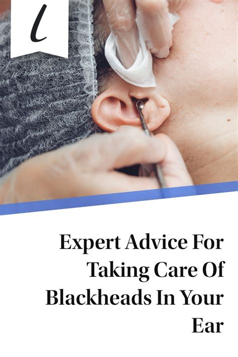 Expert Advice For Taking Care Of Blackheads In Your Ear The List