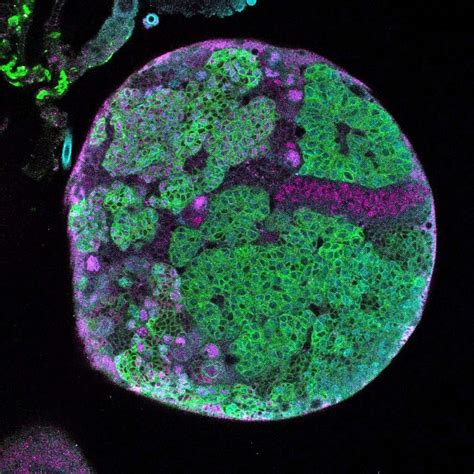 Uo Researchers Show How Fruit Fly Stem Cells Are Kept In Check During Brain Development Oregonnews