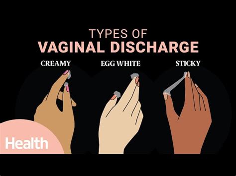 Female Discharge