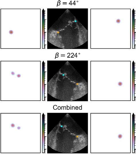 Figure 4 From Mitral Annulus Segmentation Using Deep Learning In 3 D Transesophageal