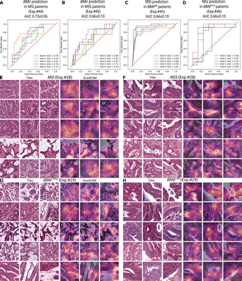 generalizable biomarker prediction from cancer pathology slides with